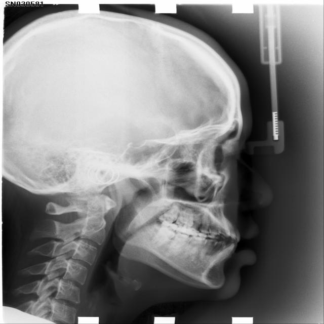 Ceph Object Detection Dataset and Pre-Trained Model by Andrea