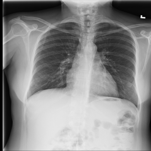 Normal Object Detection Dataset by Normal