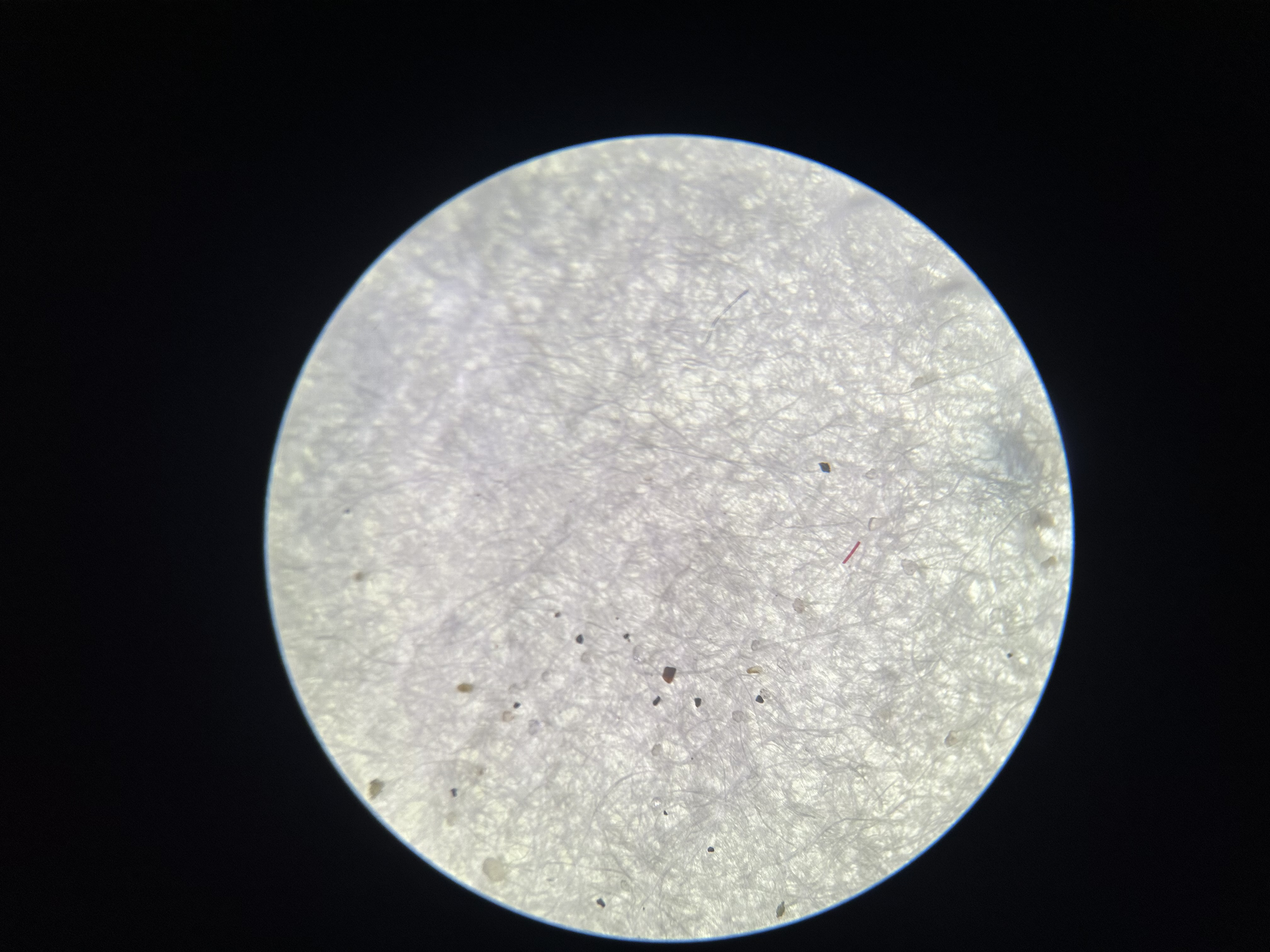 Marine Microplastic AI Detector Object Detection Model (v5, 2026-01-23 ...