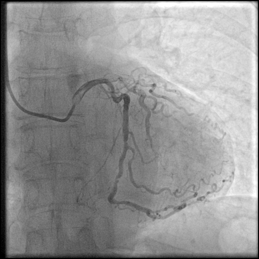 vessels_instance Instance Segmentation Model by Nazarbayev University