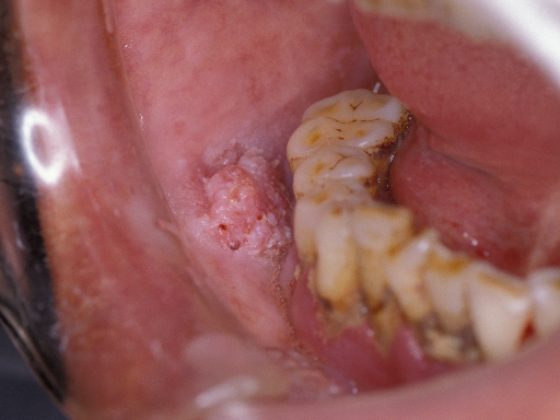 Val Object Detection Dataset By Mouth Detection