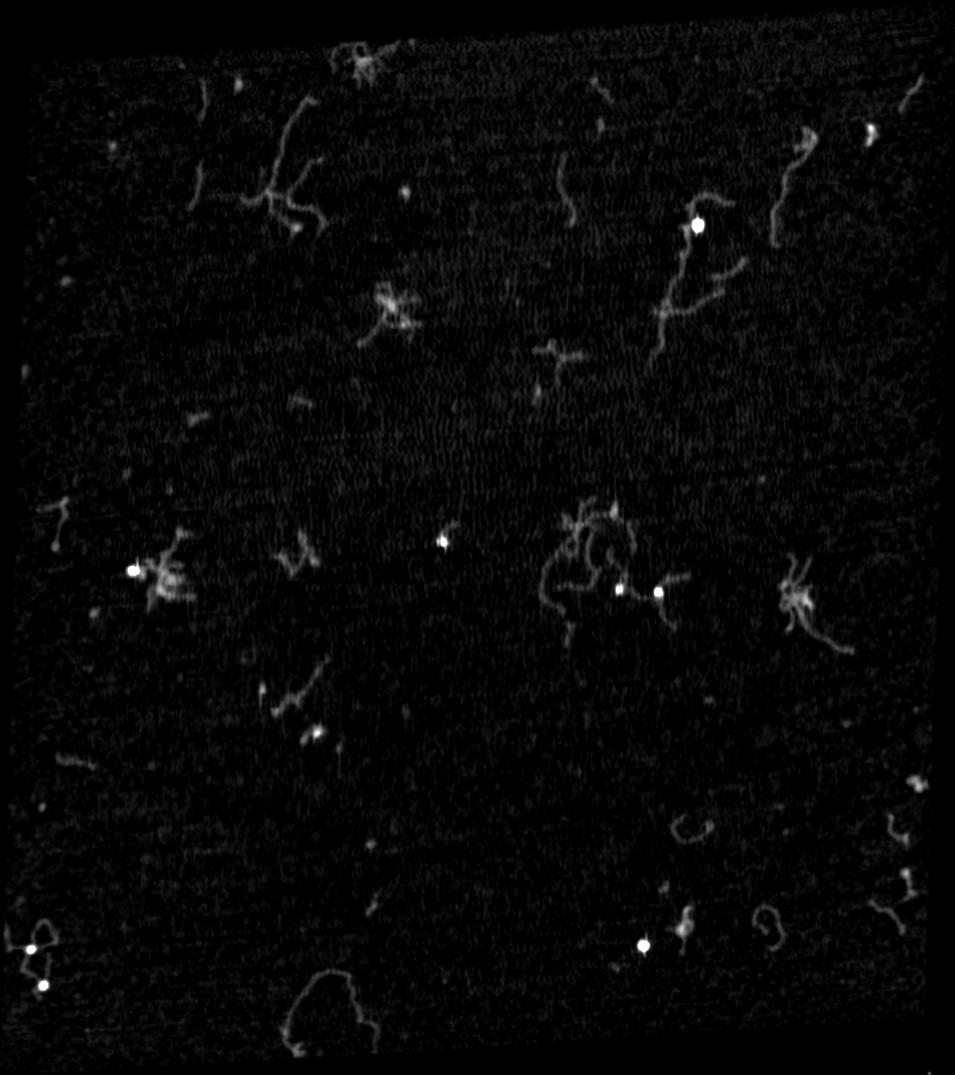 single labelled dna Object Detection Dataset by FMR1