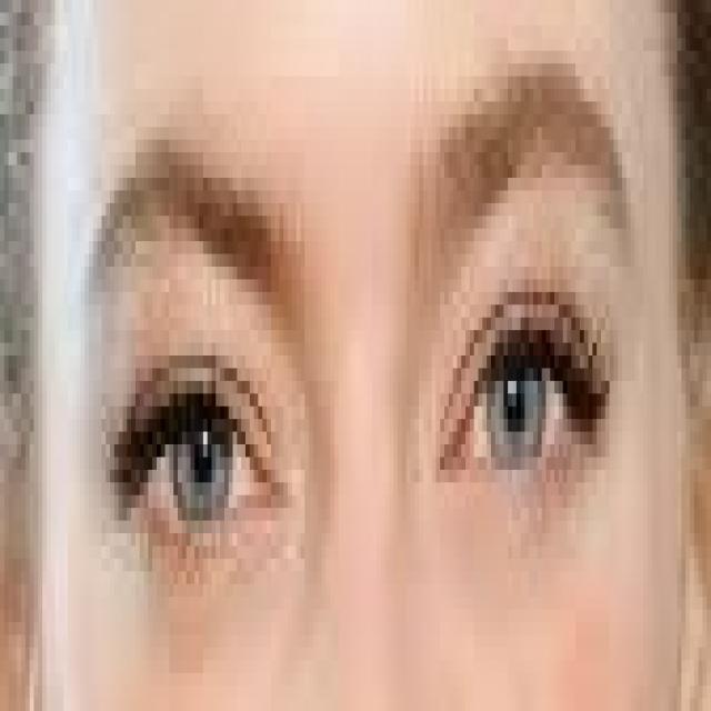 Cataract Object Detection Model By Asadeltech