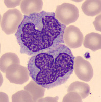 Blood cell counting Instance Segmentation Model by Pedro Gomes