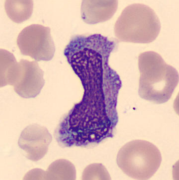 Blood cell counting Instance Segmentation Model by Pedro Gomes
