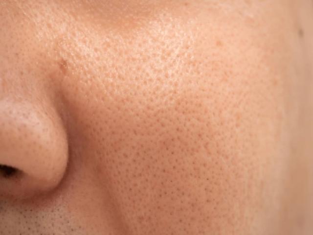 pores Instance Segmentation Model by Deep Learning