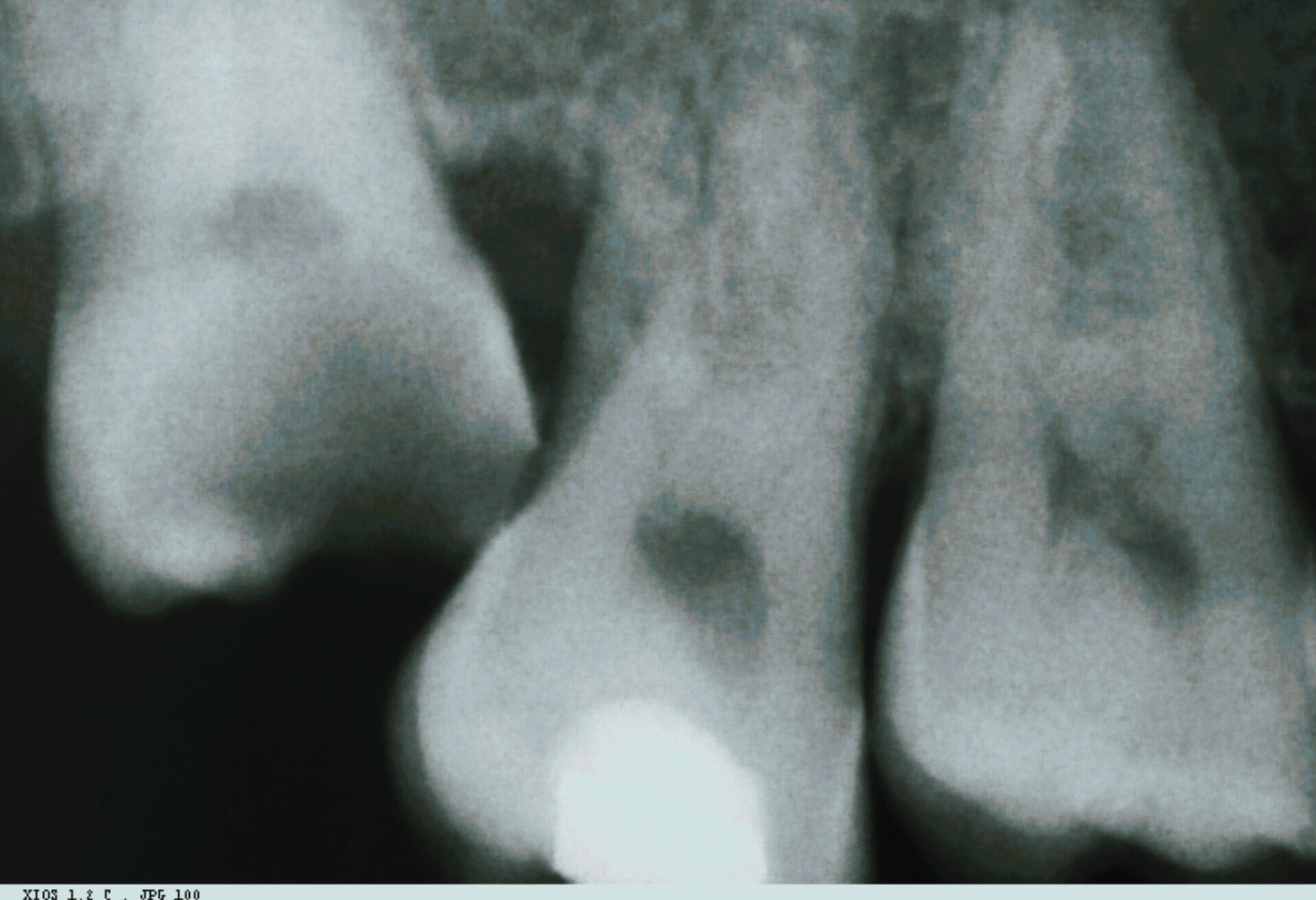 Dental Project Object Detection Model By Dental Ai
