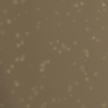 Plaque Detector Object Detection Dataset and Pre-Trained Model by Phage ML