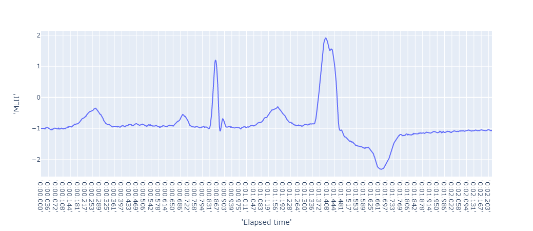 Pvc In Ecg Signal Object Detection Dataset V5 2022 12 18 11 47am By