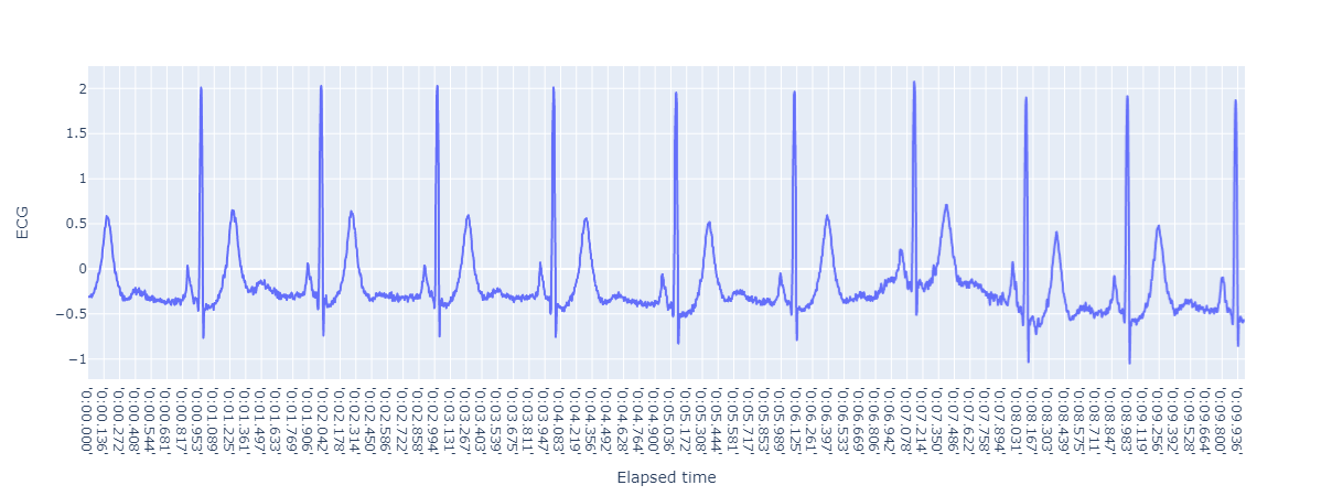 Frequncy Ecg Object Detection Dataset V1 2023 02 21 5 13pm By Ljiet