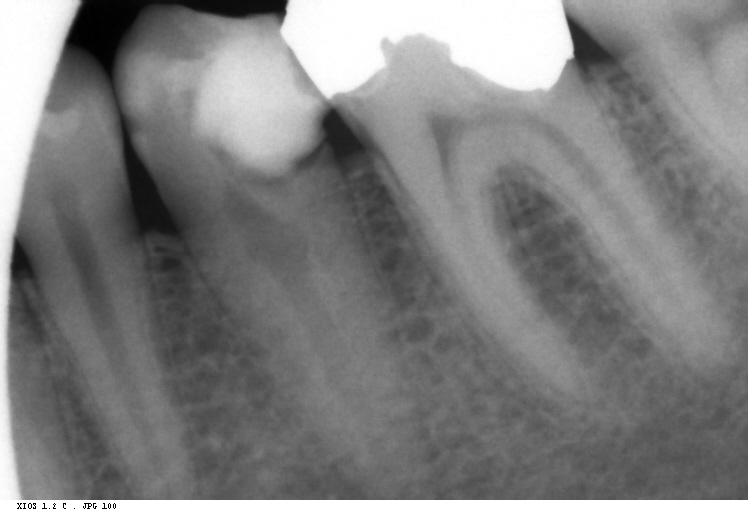 Tooth segmentation Object Detection Dataset by Project