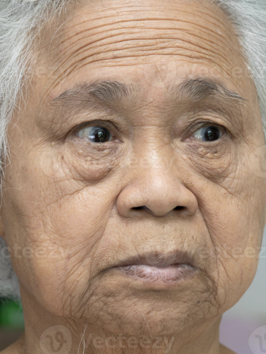 Skin problems 2 Object Detection Model by bdle