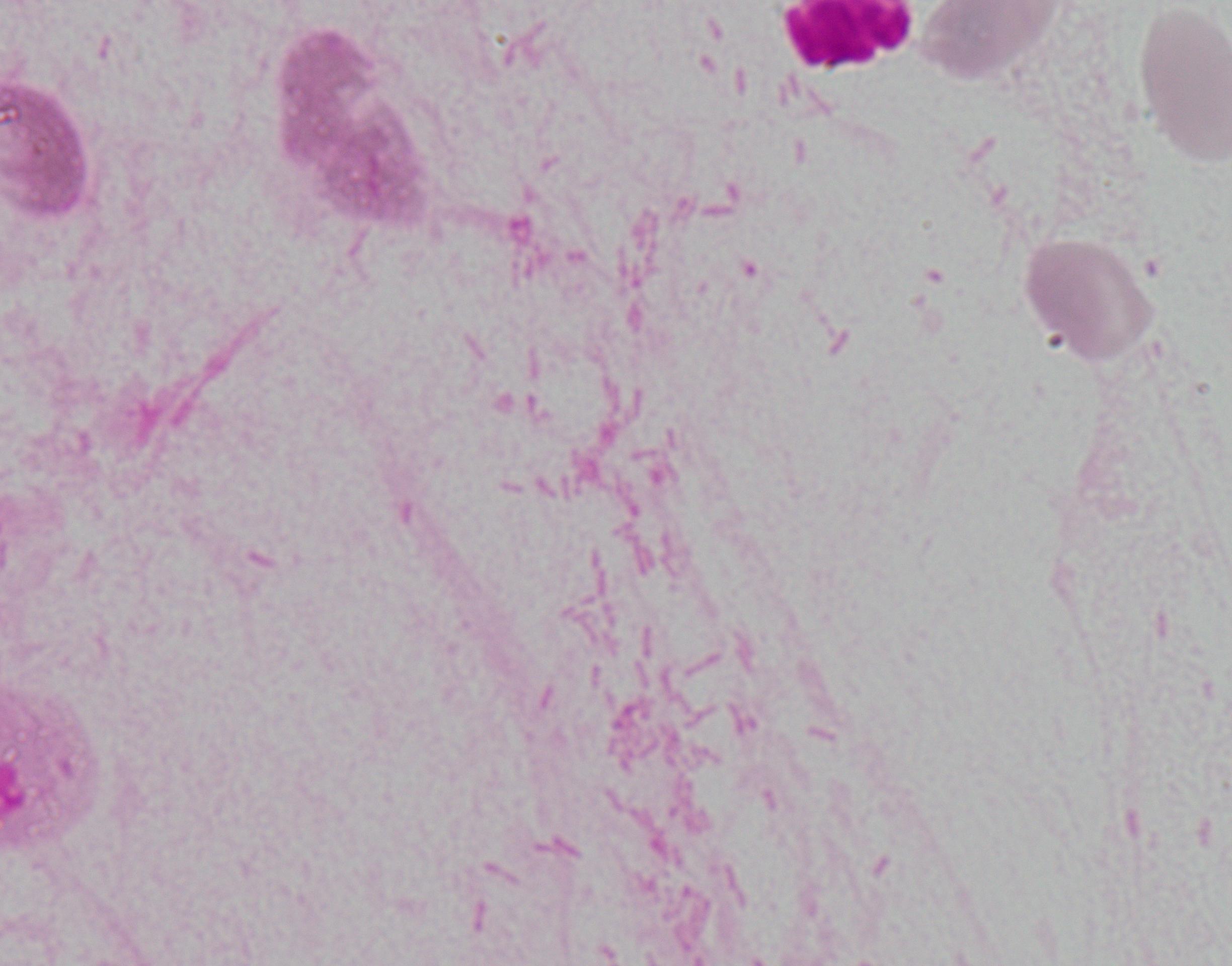 Haemo Object Detection Dataset by Kimiko Matsuoka