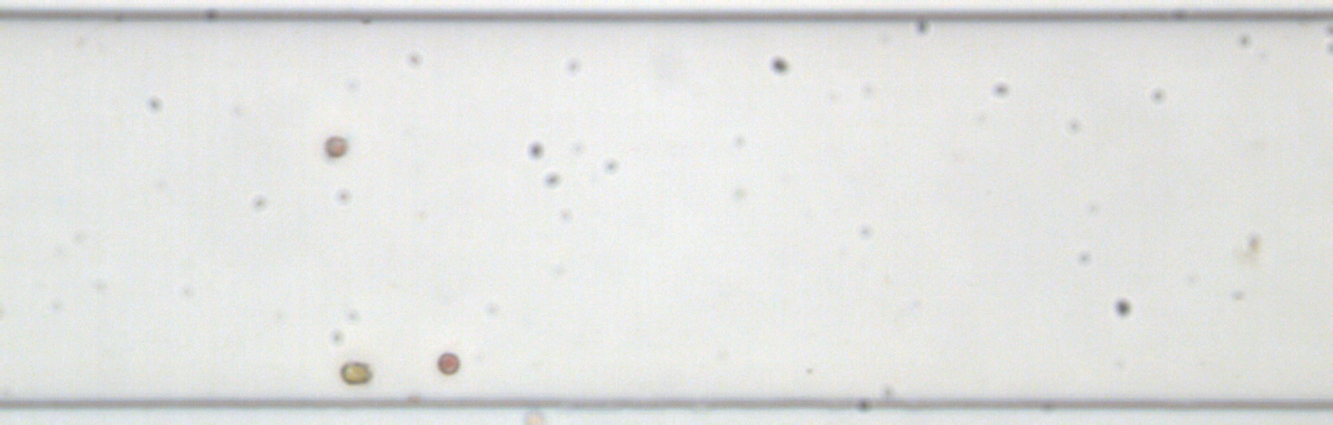 algae Object Detection Dataset by algaeibegyou