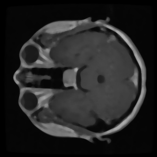 Median Kernel 7 Object Detection Dataset by Amalia