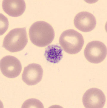 blood cells Classification Dataset by cavity