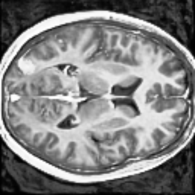 brain_more_train Instance Segmentation Dataset by test