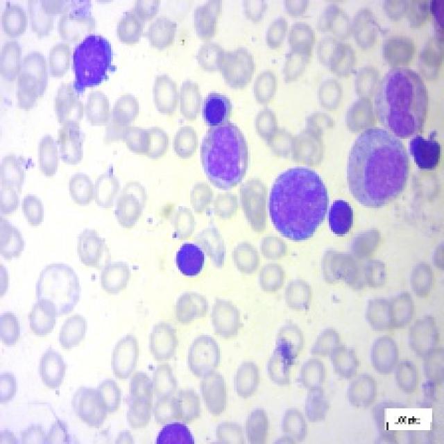 Blastos-NaoBlastos Object Detection Model by Andreys workspace