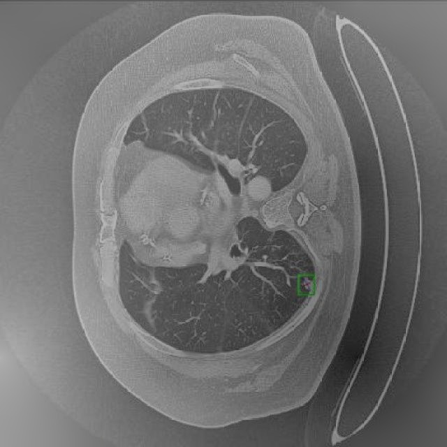 Lung Nodule Segmentation study Instance Segmentation Dataset by Varun Lung Nodule Segmentation study Instance Segmentation Dataset by Varun