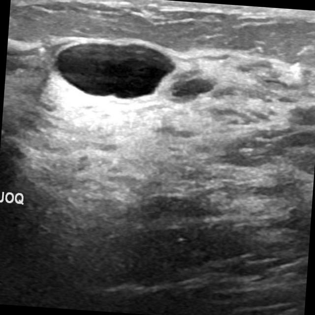 object segmentation Instance Segmentation Dataset and Pre-Trained Model by 413221060Amanda ...