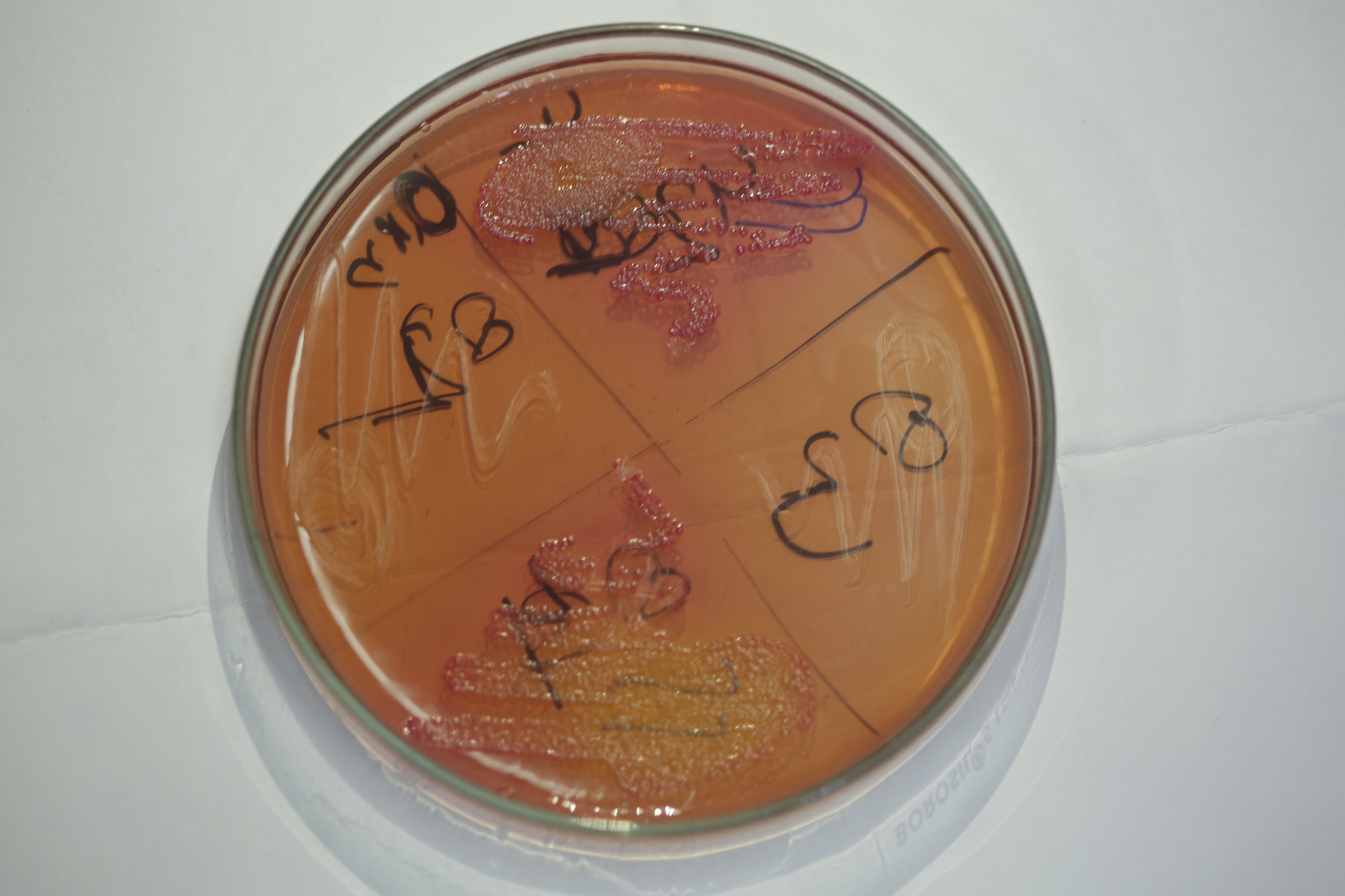 Bacteria_Yolov9 Object Detection Dataset by BacteriaDetection