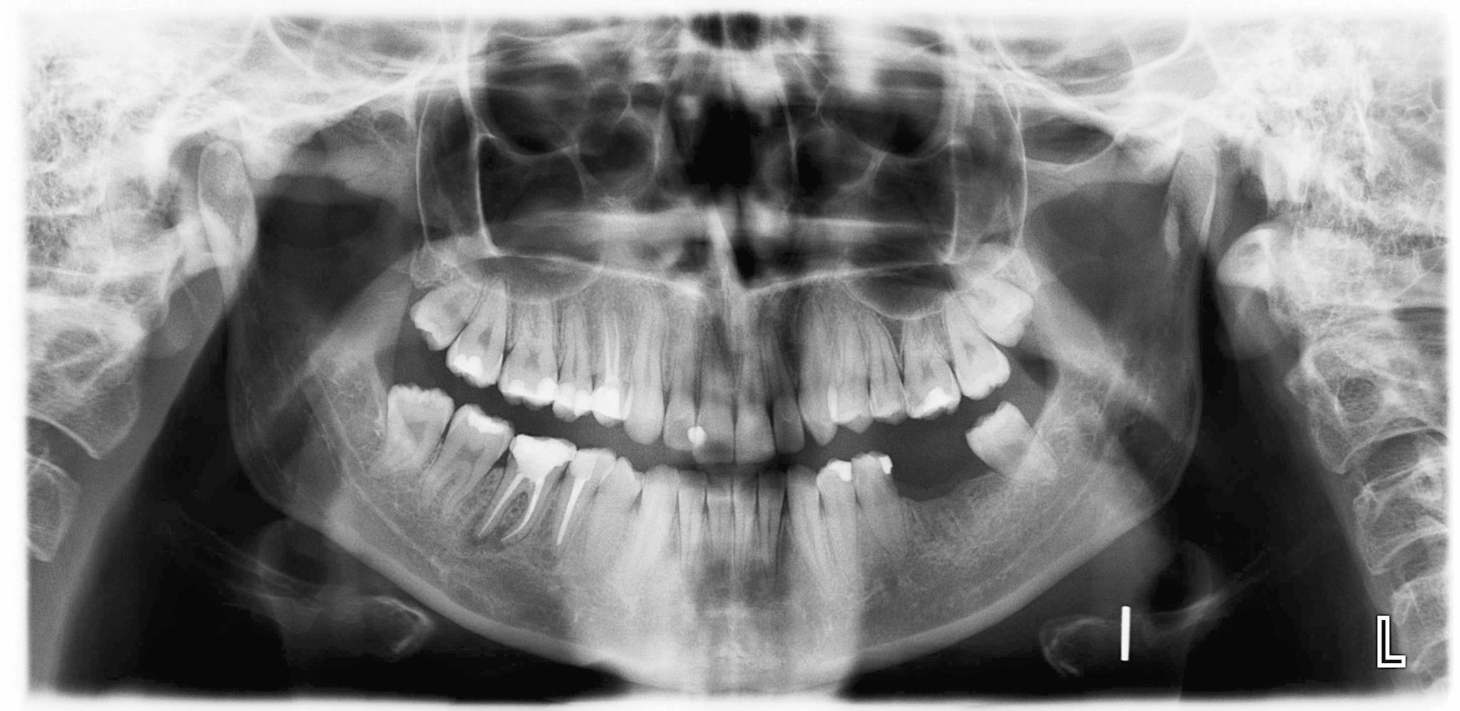 ViT Test Semantic Segmentation Dataset and Pre-Trained Model by Nihatcan