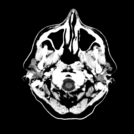 Image Recognition training Object Detection Dataset by new-workspace-lyioh