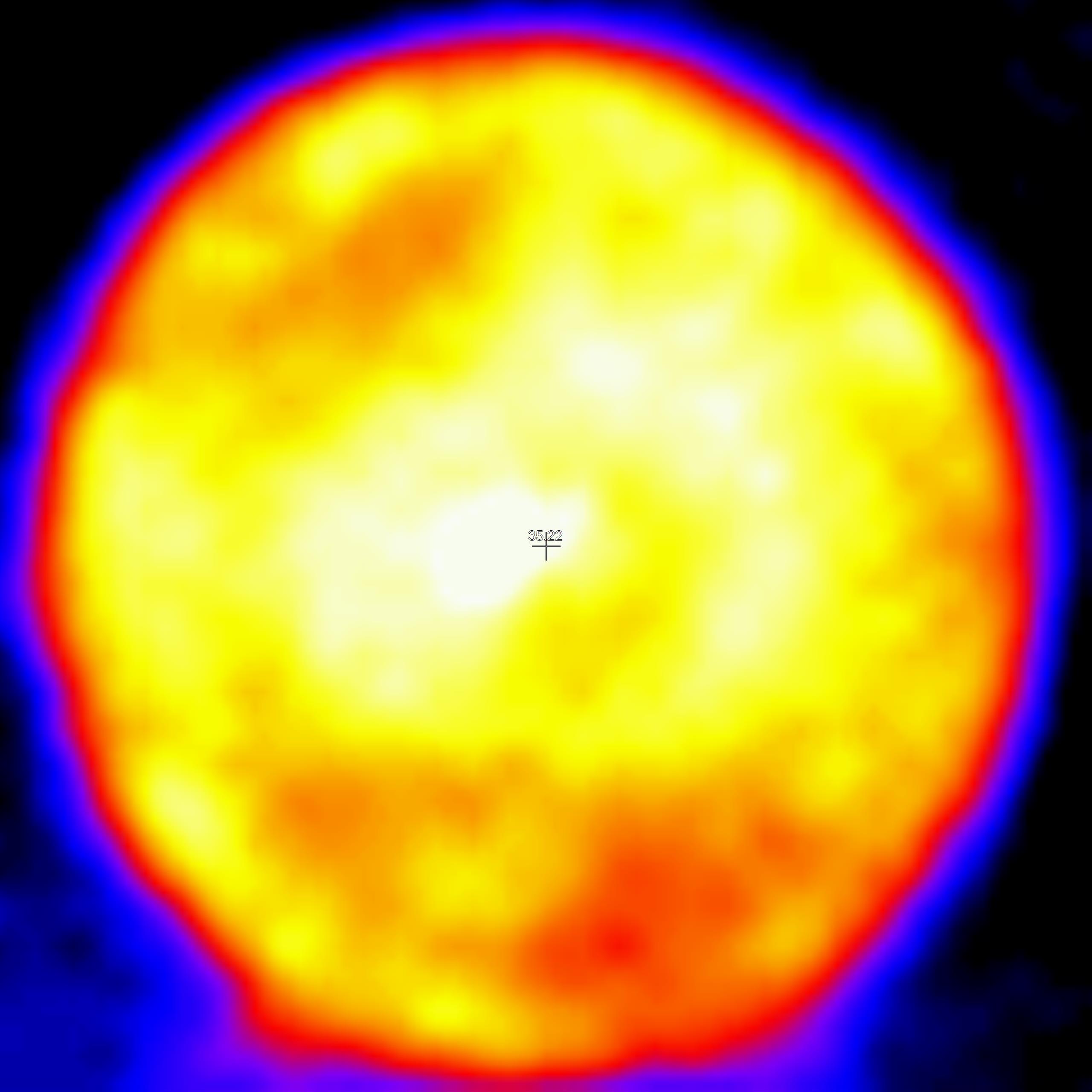 induc Classification Model by induc