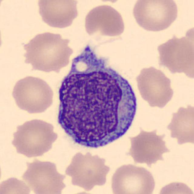 CBC-Complete Blood Cell Classification Dataset by microsystems lab