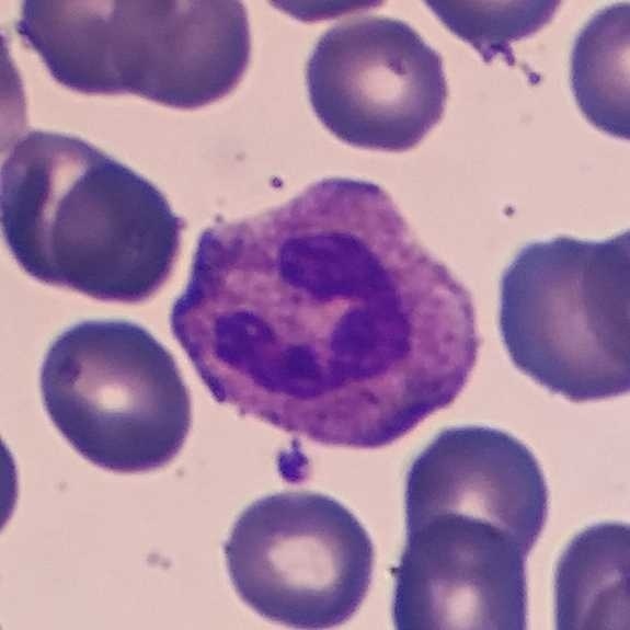 wbc classification Object Detection Model by microsystems lab