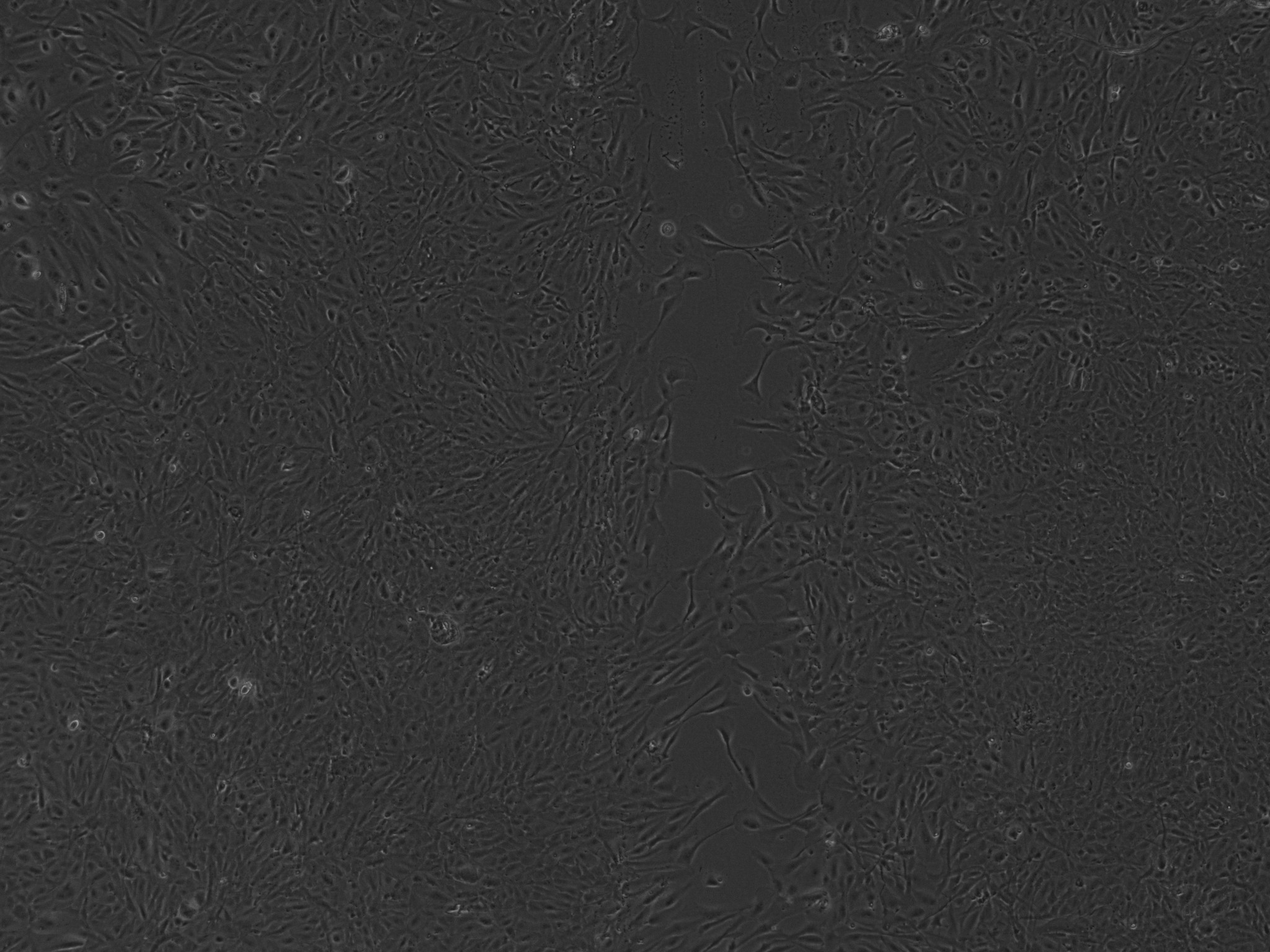 ImageJ Instance Segmentation Dataset by Radit