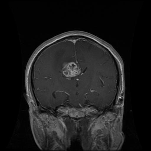 Object Classification Classification Model by Louisas Workspace