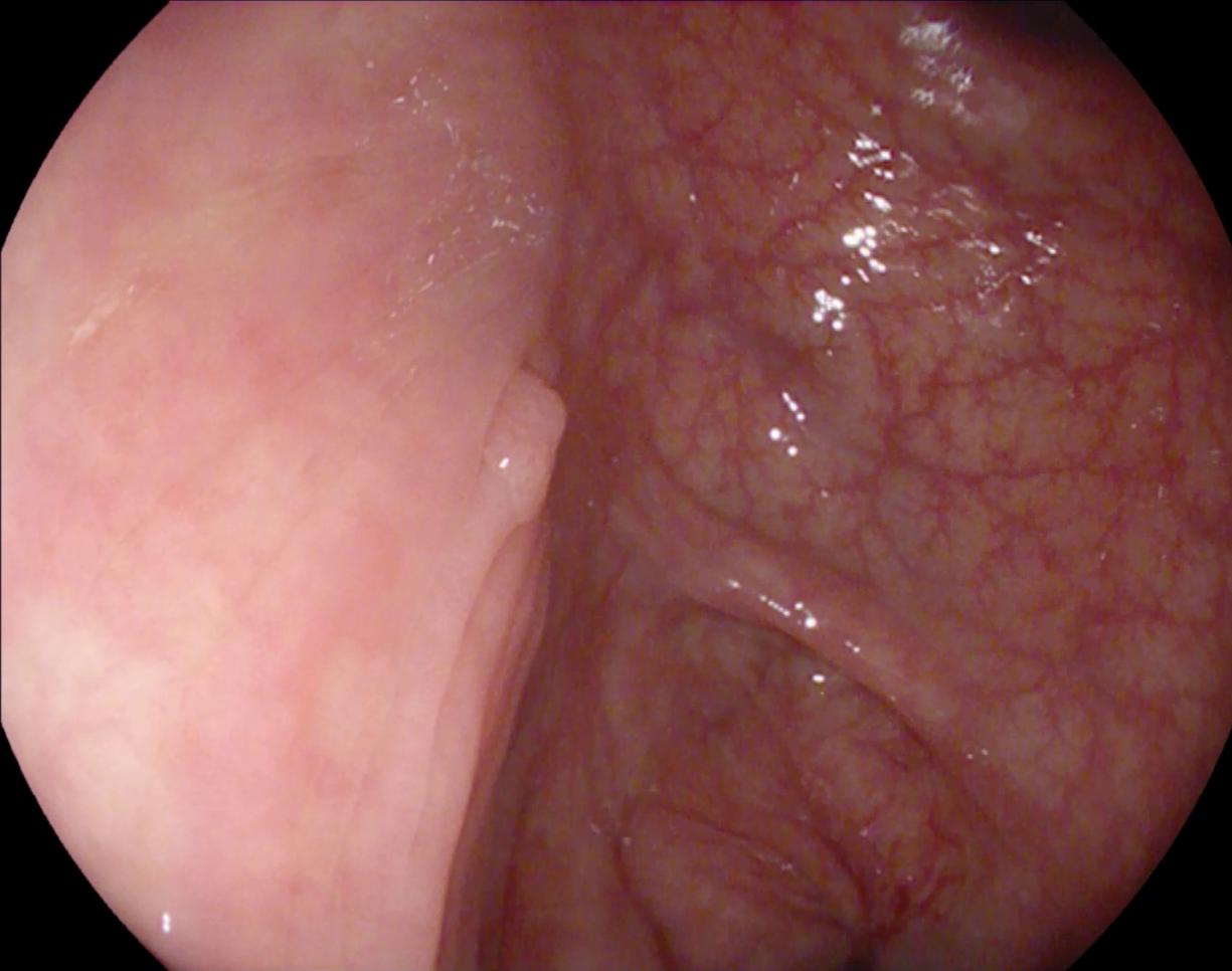 Thesis-ETISLarib Object Detection Model by Thesis Implementation