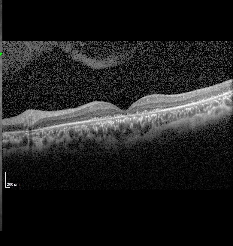 OCT 2 Object Detection Dataset by projects