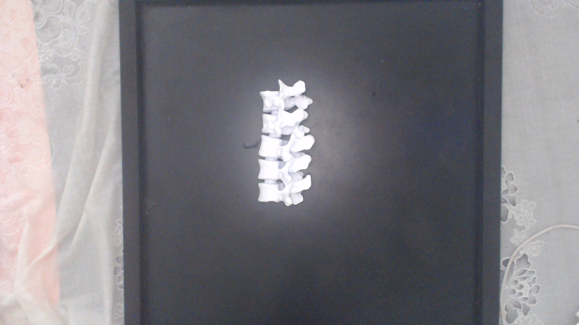 Bone Identifier Object Detection Model by Ossos