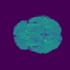 Brain_Tumour1 Object Detection Dataset and Pre-Trained Model by ...