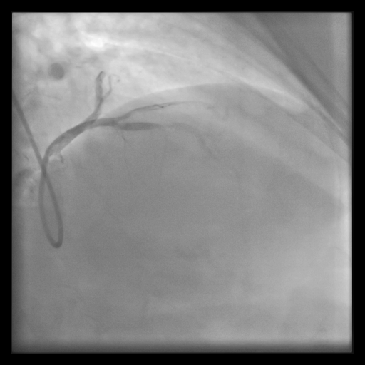 Corona Object Detection Dataset and Pre-Trained Model by corona