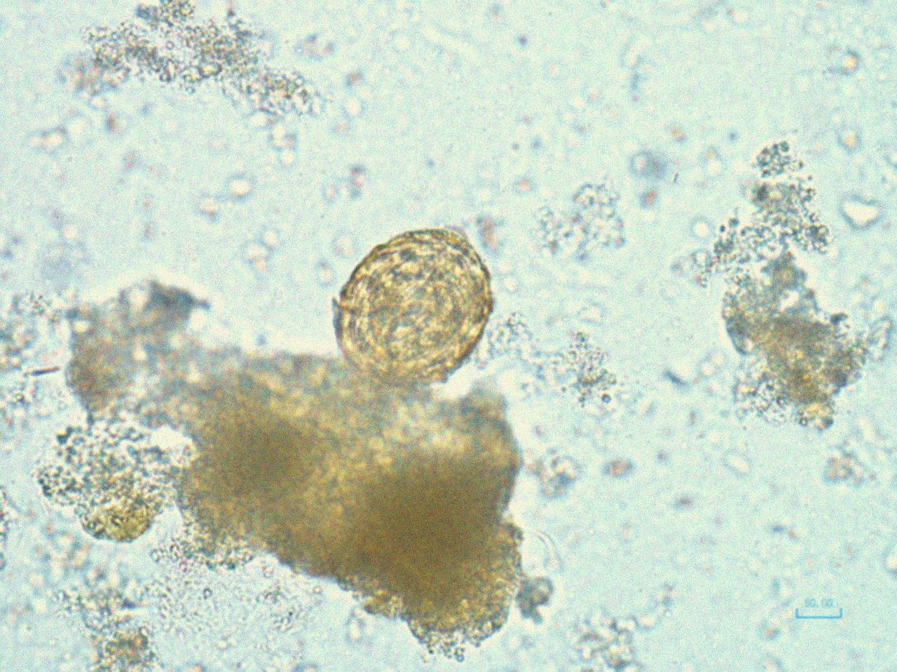 ParasiteEggs Object Detection Dataset by Parasite Eggs