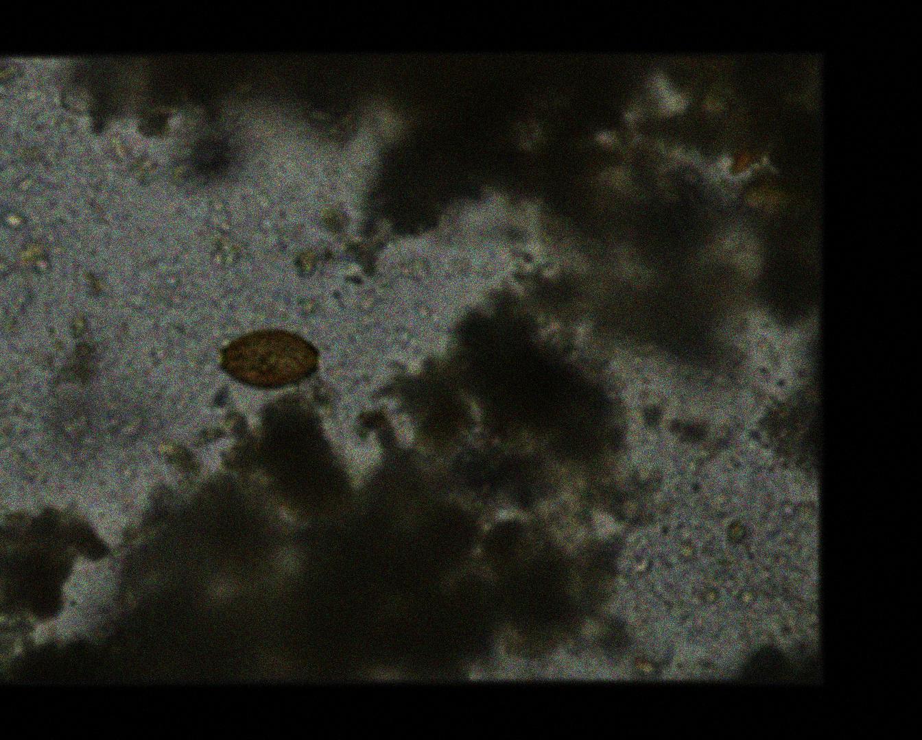 parasite test Object Detection Dataset by Parasite Eggs
