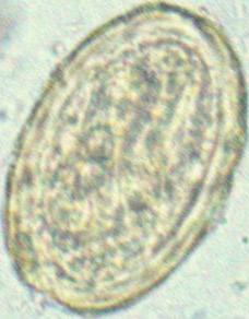 parasite_crop Object Detection Dataset by Parasite Eggs