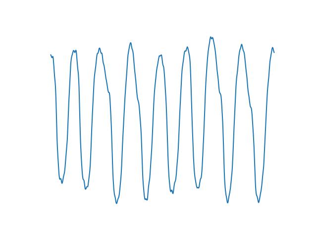 Ecg Image Object Detection Dataset And Pre Trained Model By Ecg