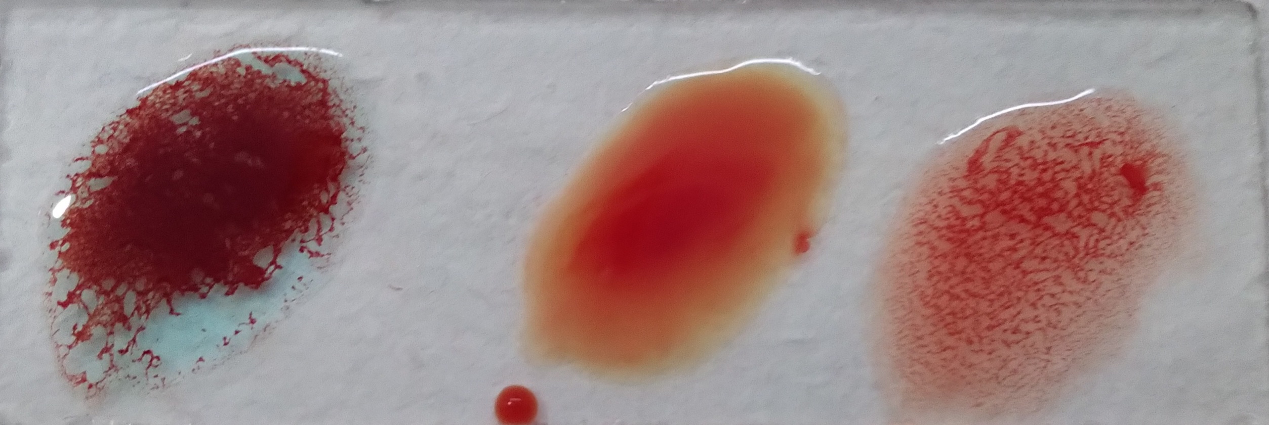 Blood Group Detection Object Detection Dataset and Pre-Trained Model by ...