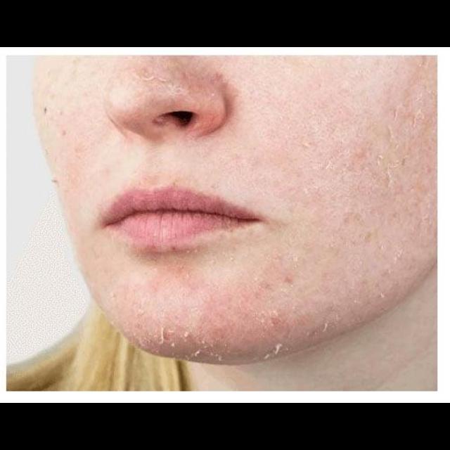 Skin_Types Classification Model by Skin type