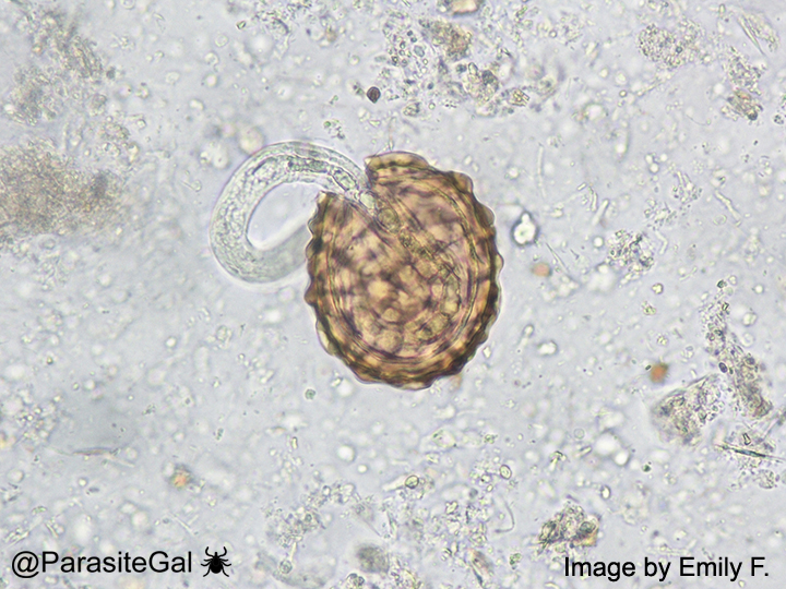 diagnosis-intestinal-parasites Object Detection Dataset by Raymond Chan