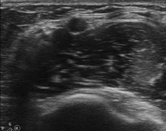 vessel Instance Segmentation Dataset and Pre-Trained Model by Miyamori