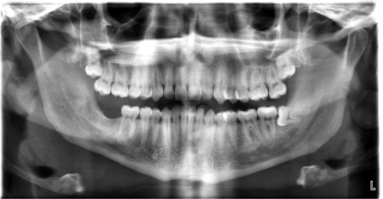 nerd - Roboflow Universe