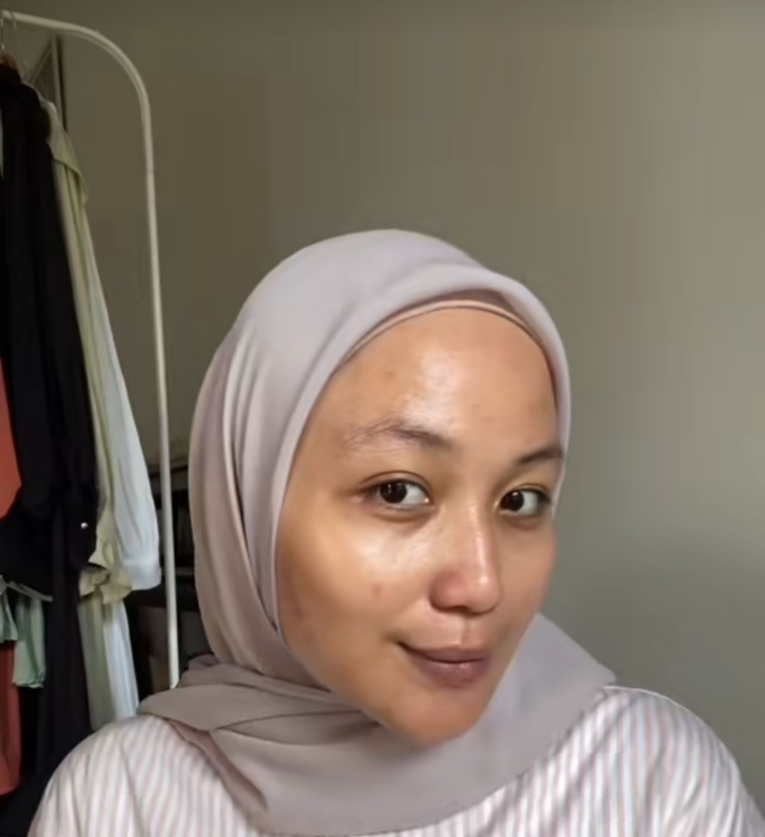 Pengenalan Jenis Kulit Manusia Object Detection Dataset and Pre-Trained Model by Skripsi