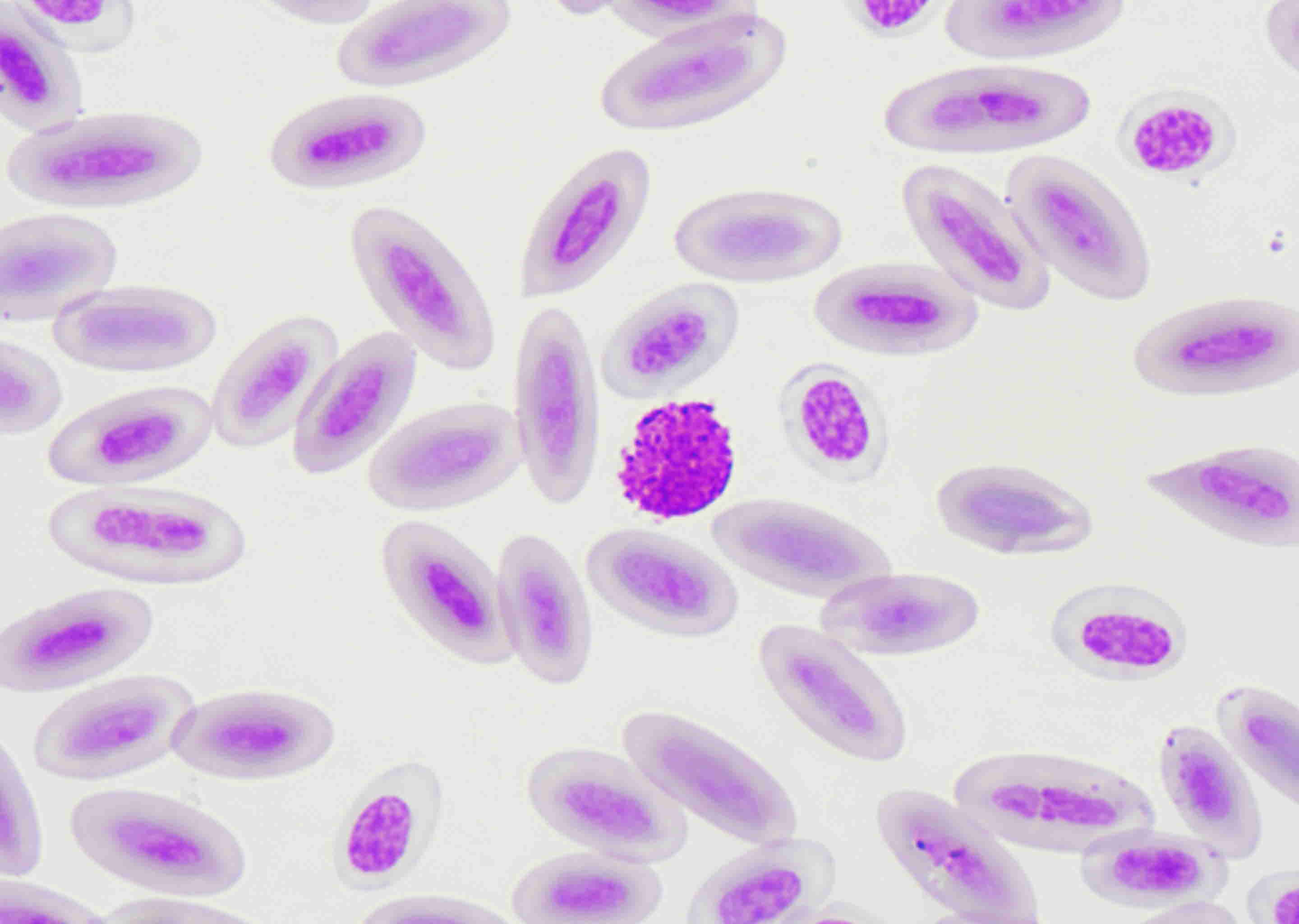 Vertical Object Detection Dataset by Classification of White Blood ...