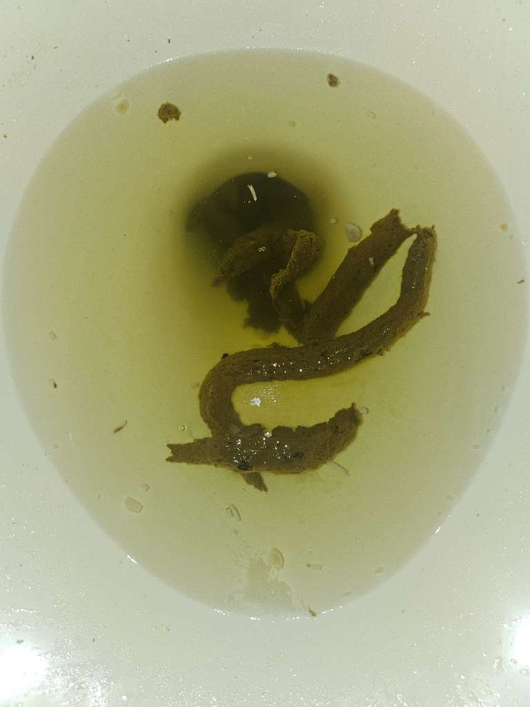 Poop_No.4 Semantic Segmentation Dataset by SKTFLYAI