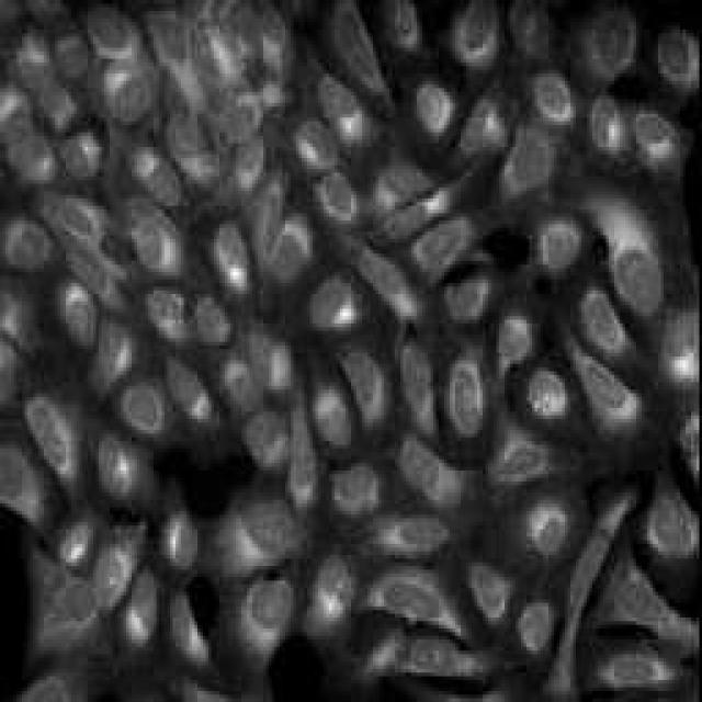 Cells Detections Object Detection Dataset And Pre Trained Model By Cells